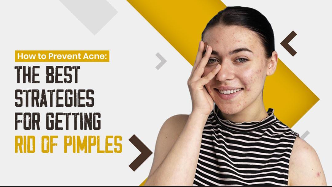 How to Prevent Acne: The Best Strategies for Getting Rid of Pimples